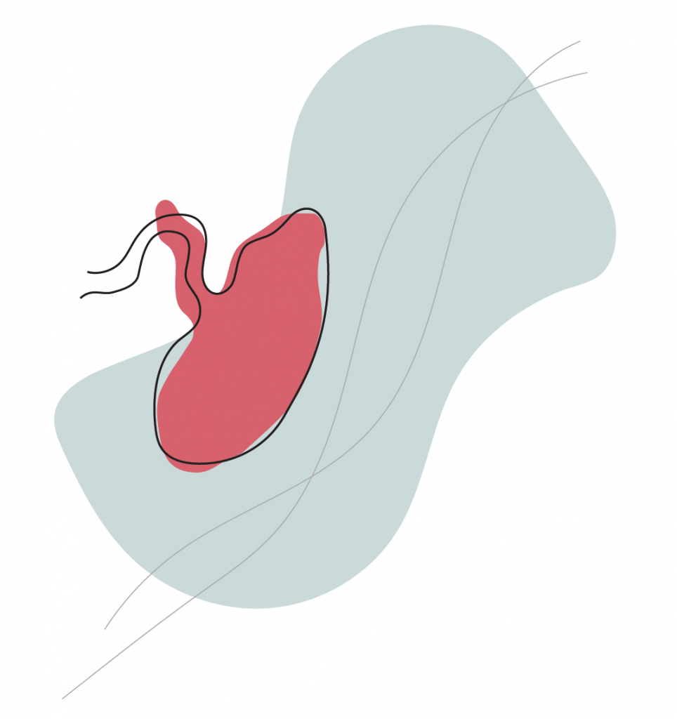 Placenta Cancer – Australian Gynaecological Cancer Foundation